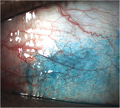 Optometric Management | PentaVision