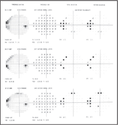Optometric Management | PentaVision