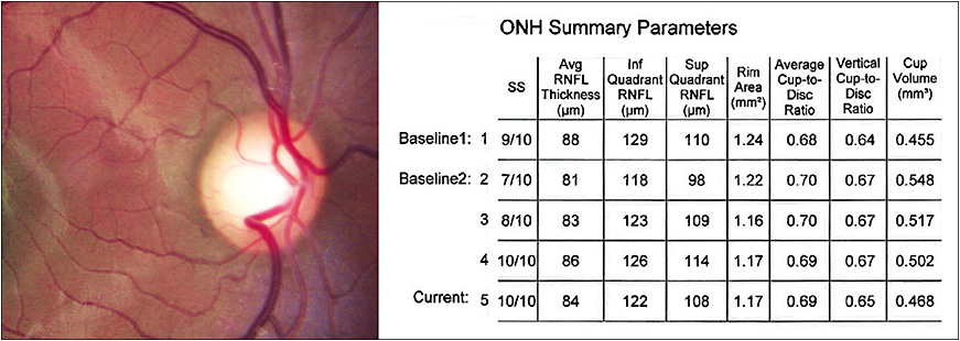 Optometric Management | PentaVision