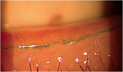 Optometric Management | PentaVision