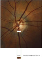 Optometric Management | PentaVision