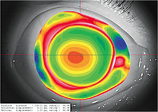 Optometric Management | PentaVision