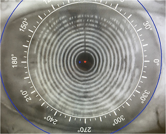Optometric Management | PentaVision