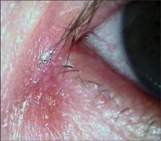 Optometric Management | PentaVision