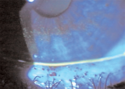 Optometric Management | PentaVision