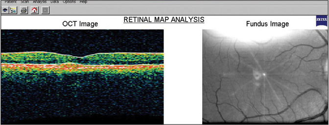 Optometric Management | PentaVision