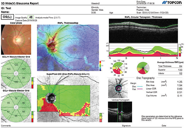 Optometric Management | PentaVision