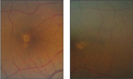 Optometric Management | PentaVision
