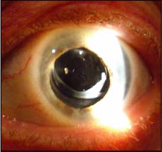 Optometric Management | PentaVision