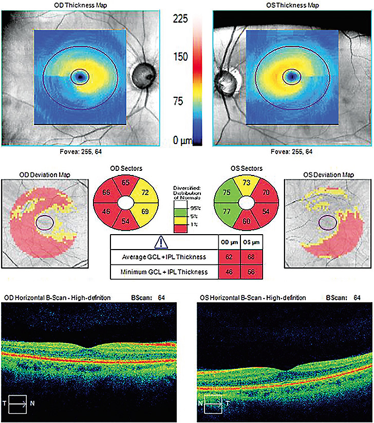 Optometric Management | PentaVision