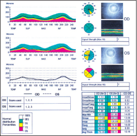 Optometric Management | PentaVision