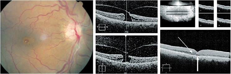 Optometric Management | PentaVision