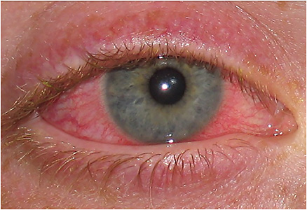 Optometric Management | PentaVision