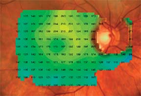 Optometric Management | PentaVision