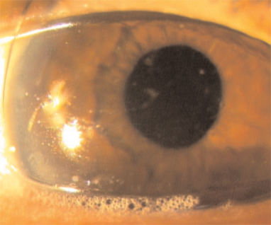 Optometric Management | PentaVision