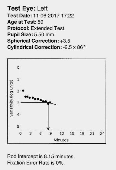 Optometric Management | PentaVision