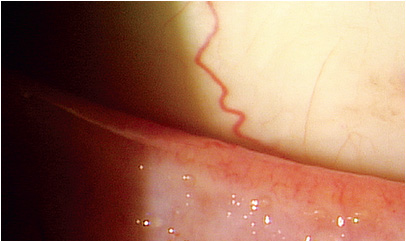 Optometric Management | PentaVision