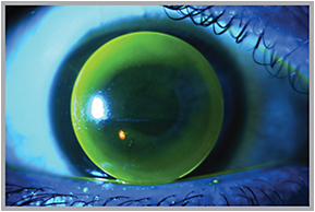 Optometric Management | PentaVision