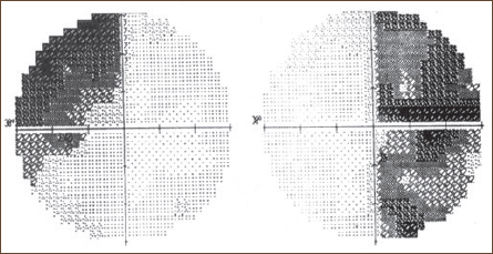 Optometric Management | PentaVision
