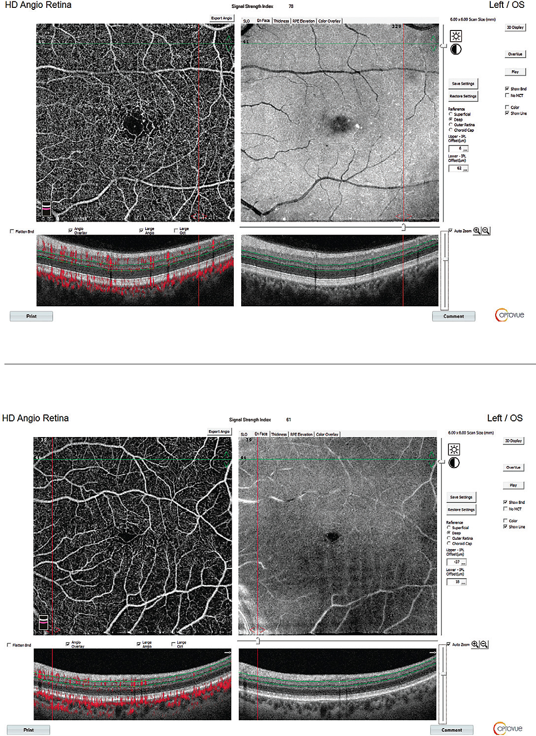 Optometric Management | PentaVision