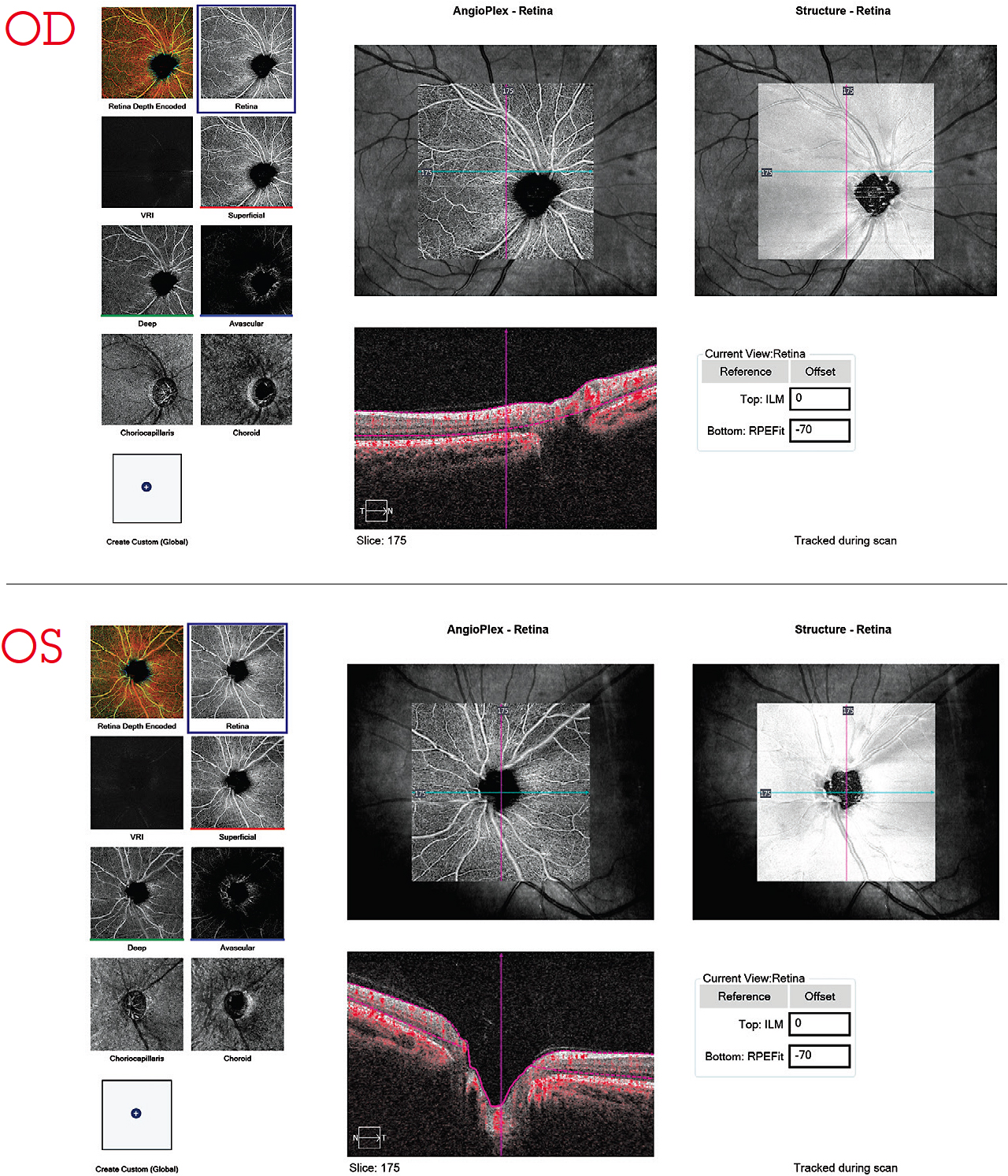 Optometric Management | PentaVision
