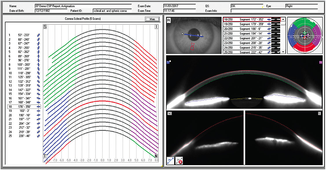 Optometric Management | PentaVision